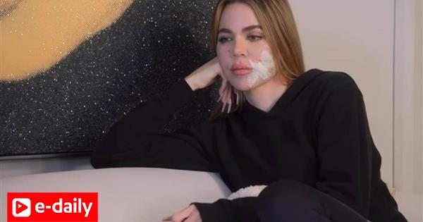 Κλόε Καρντάσιαν: Δείχνει τις ουλές από την αφαίρεση του όγκου στο μάγουλό της (video) | E-Daily.gr