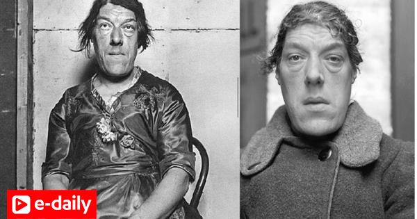 Mary Ann Bevan: Η τραγική ιστορία της «πιο άσχημης γυναίκας του κόσμου ...